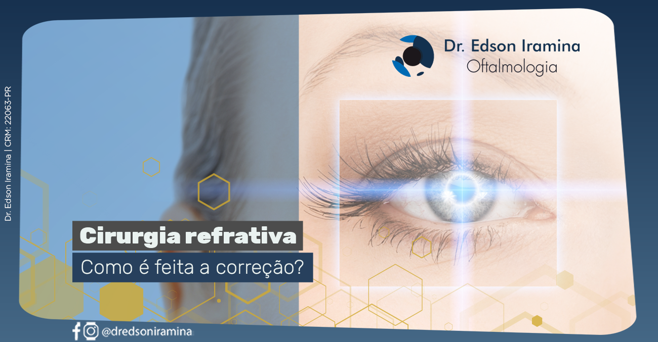 Cirurgia Refrativa - Dr. Edson Iramina - Oftalmologia